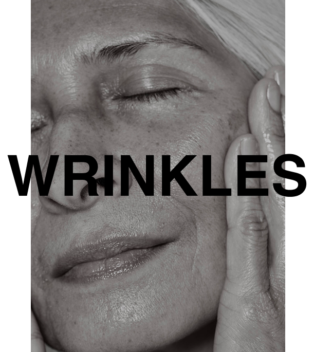 Wrinkles – Ashleigh Hasson